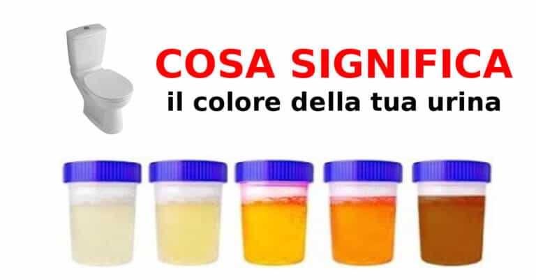 Il colore dell'urina dice tutto sulla tua salute, scopri il suo ...